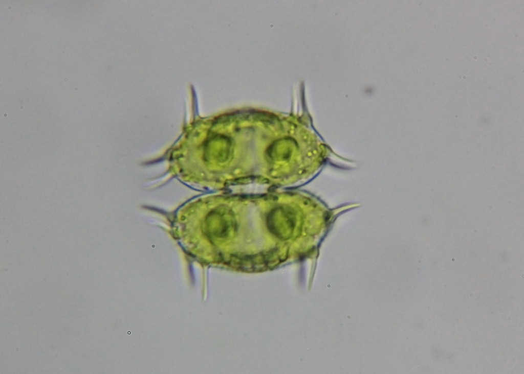 Xanthidium antilopaeum polymazum from Wood County, TX, USA on October ...