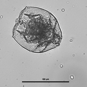 Brachionus angularis from Hamilton, ON, Canada on June 11, 2015 at 03: ...