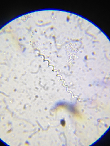 Género Spirochaeta · iNaturalist Mexico