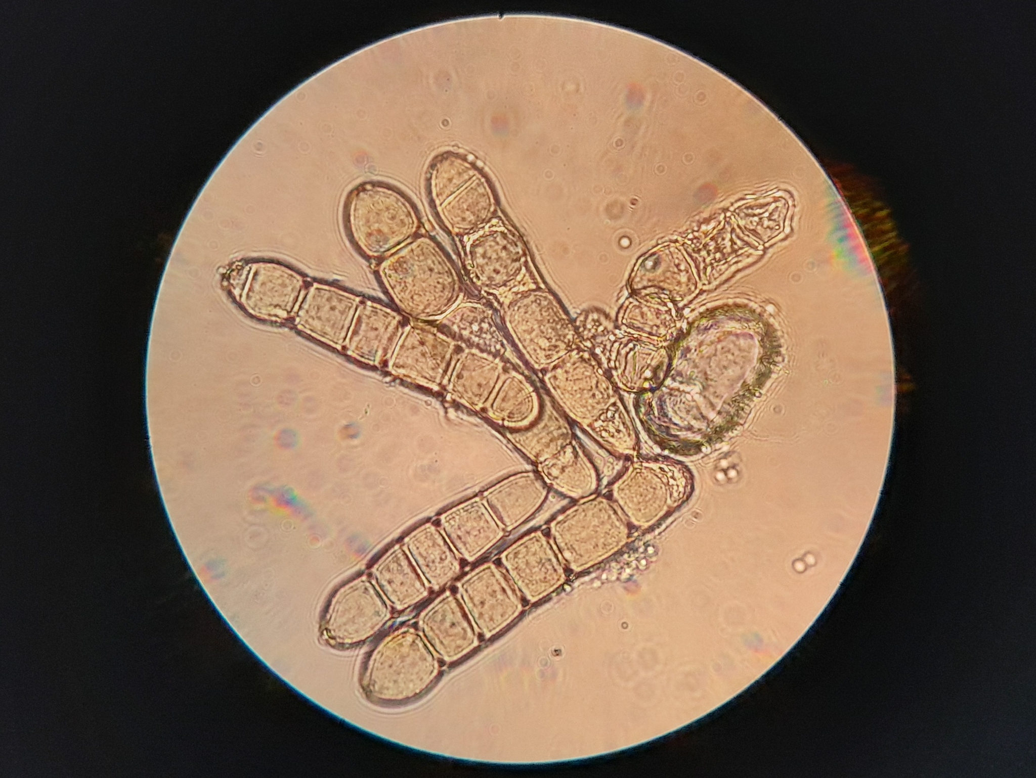 Pyrenophora teres Drechsler