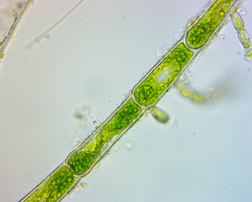 Oedogonium from South Brunswick Township, NJ, USA on October 13, 2022 ...