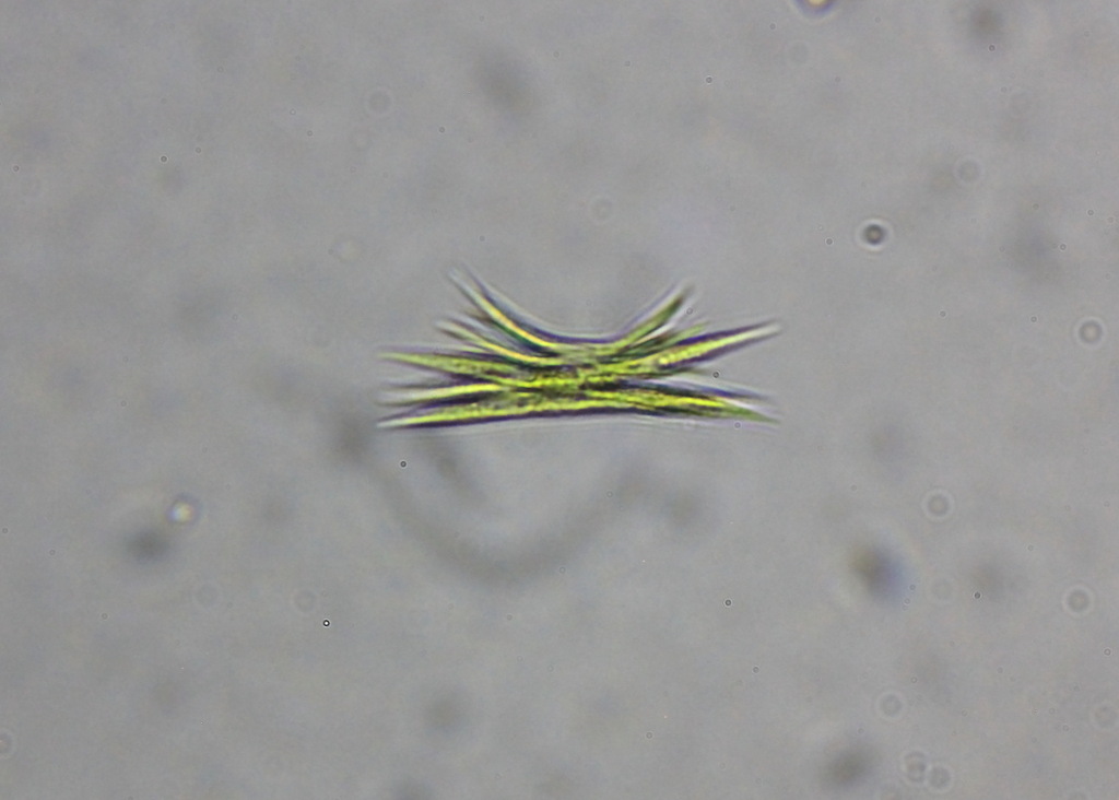 Ankistrodesmus falcatus in October 2022 by Jim Walker · iNaturalist