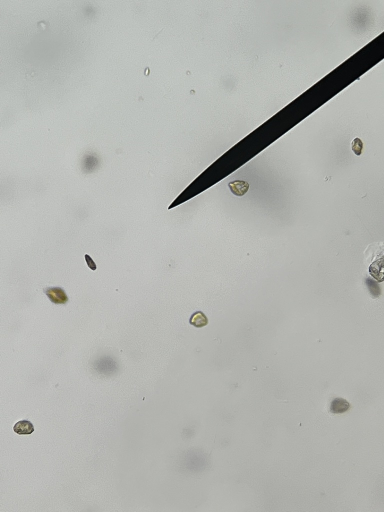 Heterosigma akashiwo from Dock LMBC Oakland, CA, USA on August 24, 2022 ...