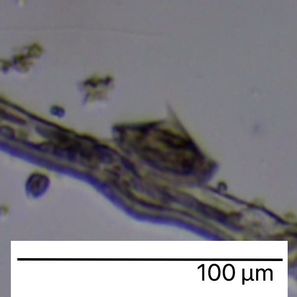 Aspidisca turrita from Glenview, IL, USA on November 10, 2022 at 04:13 ...