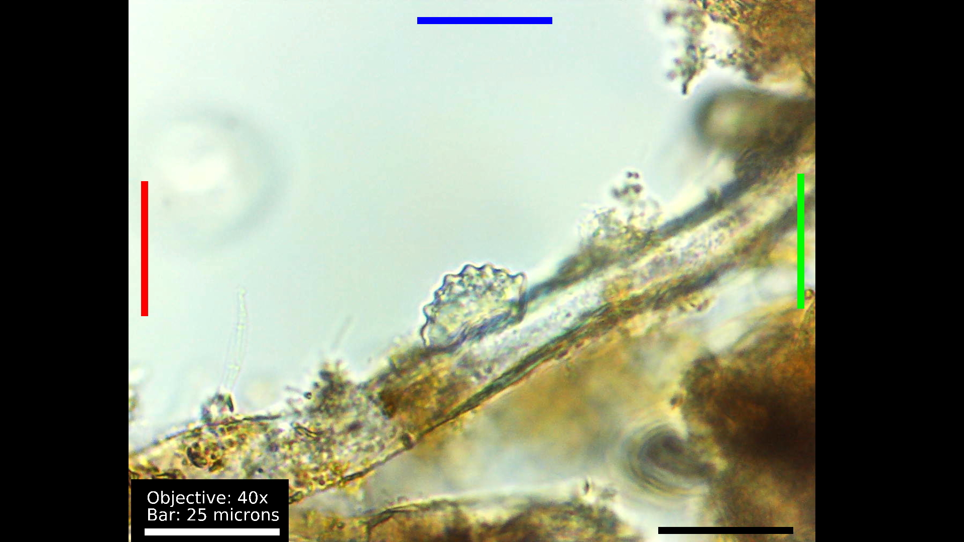 Aspidisca cicada (Müller, 1786) Claparède & Lachmann, 1858