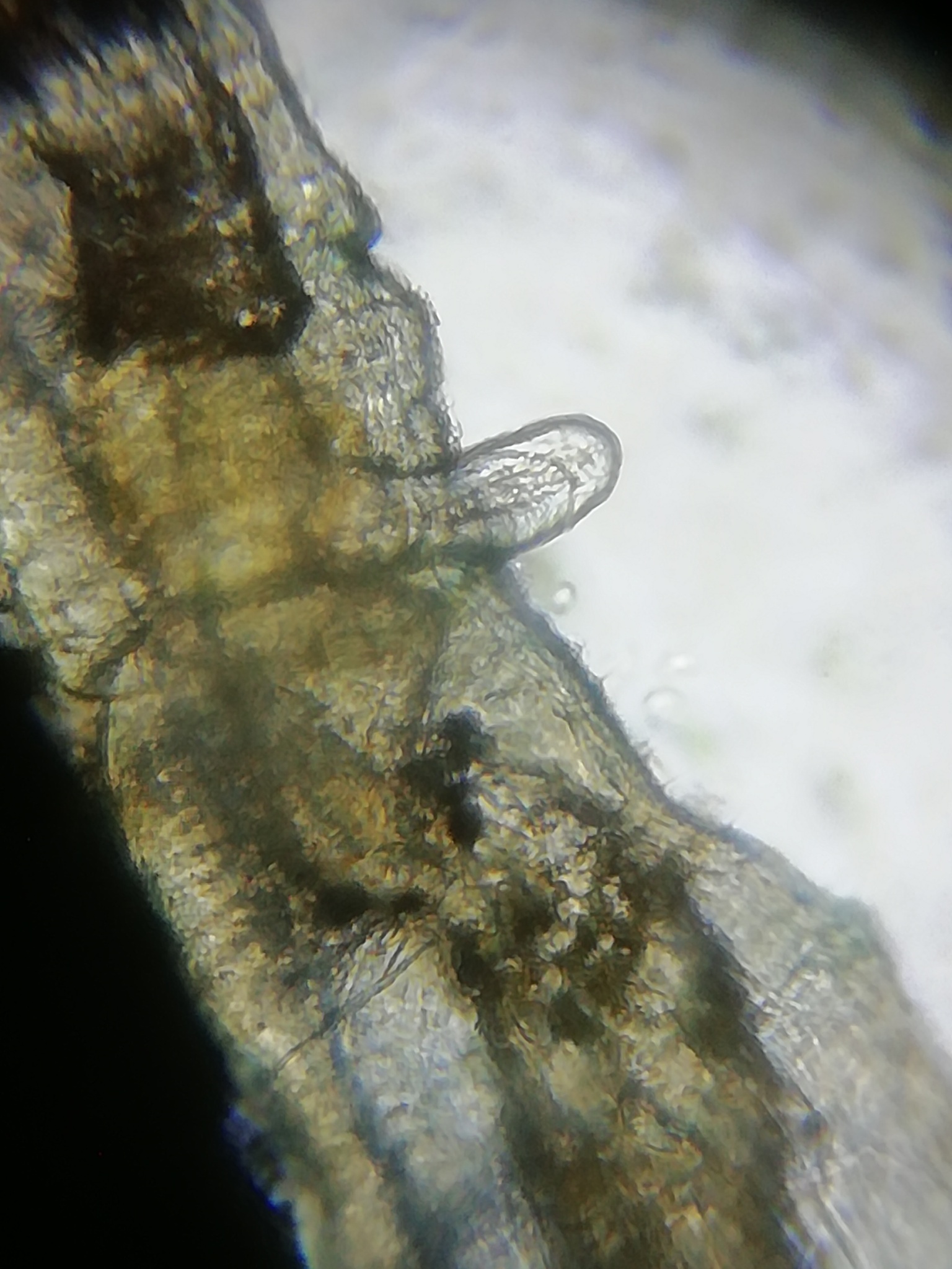 Stylaria lacustris (Linnaeus, 1758)