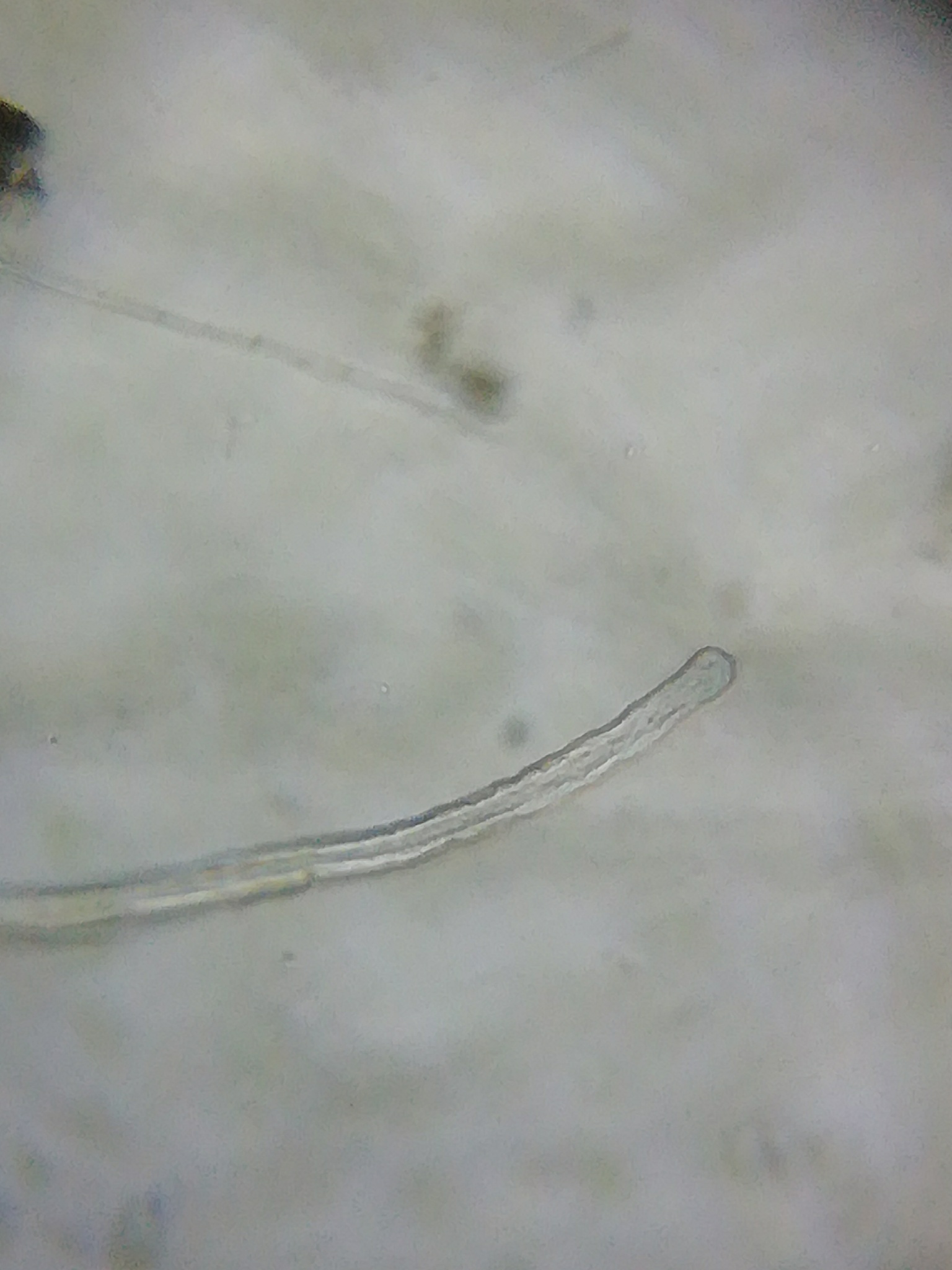 Stylaria lacustris (Linnaeus, 1758)