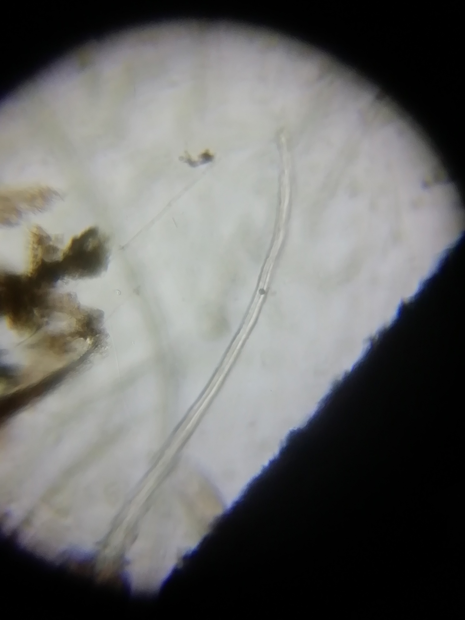 Stylaria lacustris (Linnaeus, 1758)