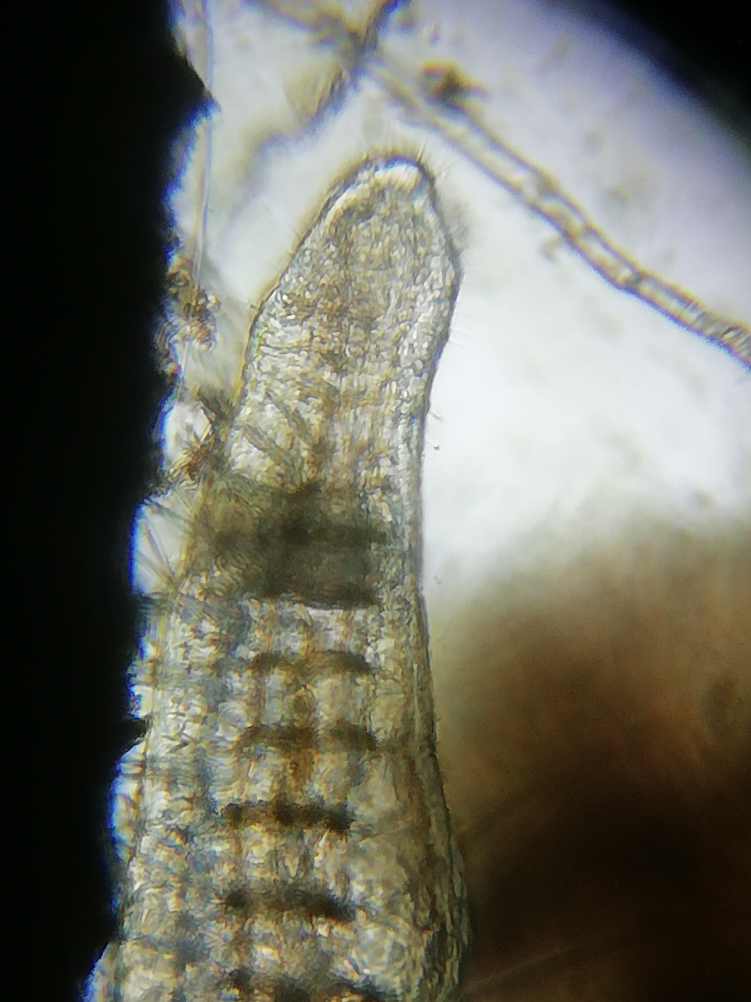 Stylaria lacustris (Linnaeus, 1758)