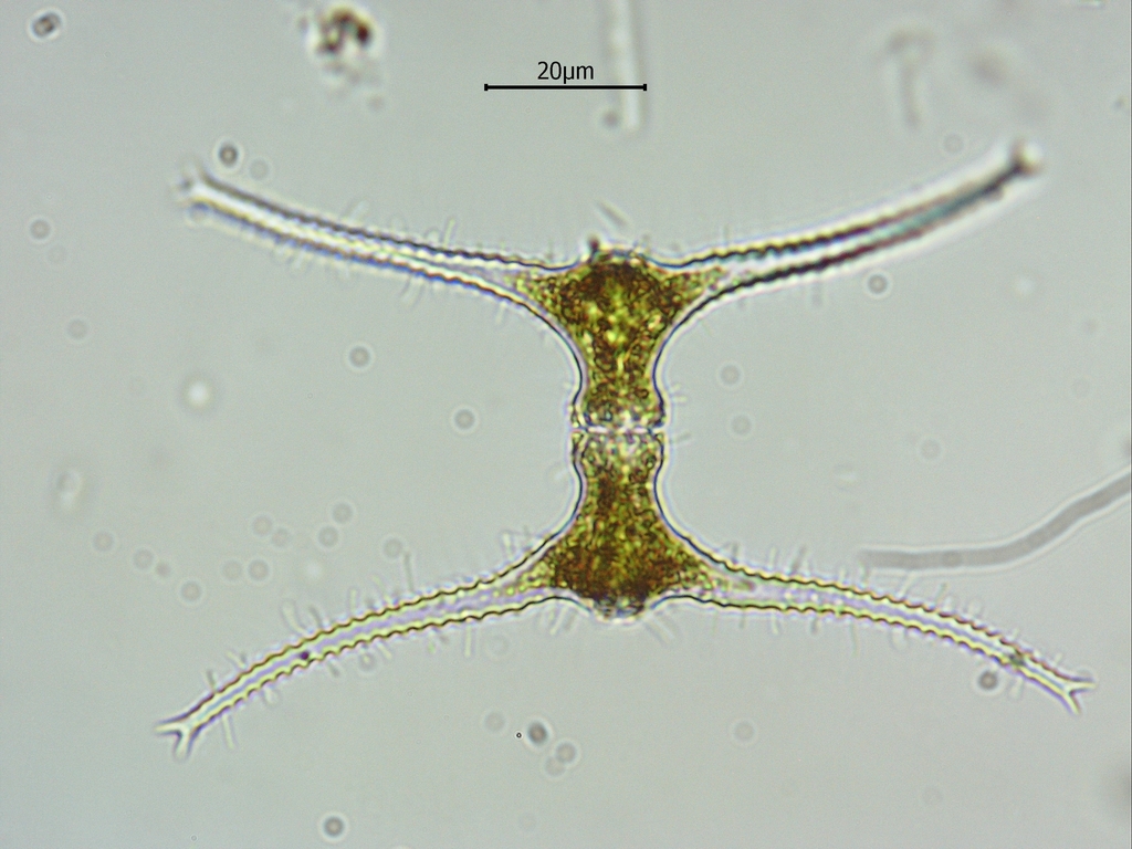 (Staurastrum leptocladum) - Botanical Realm