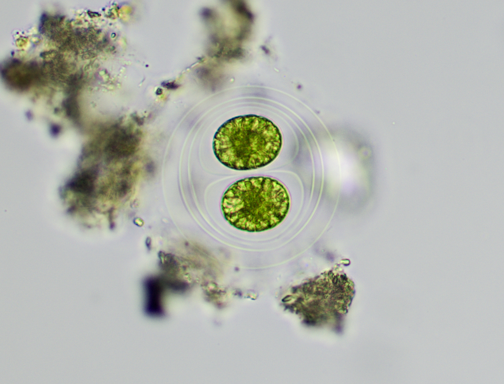 Asterococcus superbus in November 2022 by Bettina Harvey · iNaturalist