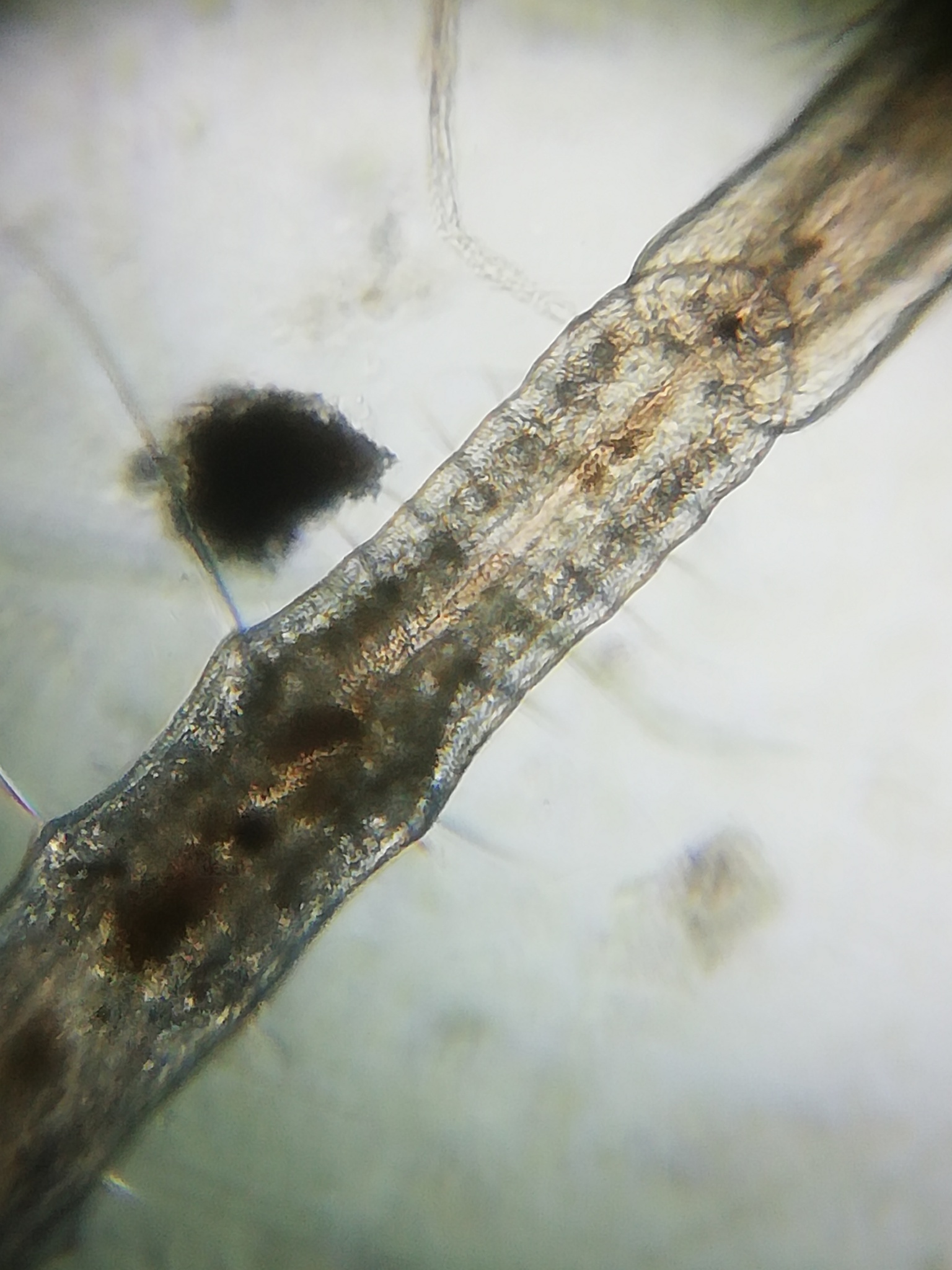 Stylaria fossularis Leidy, 1852