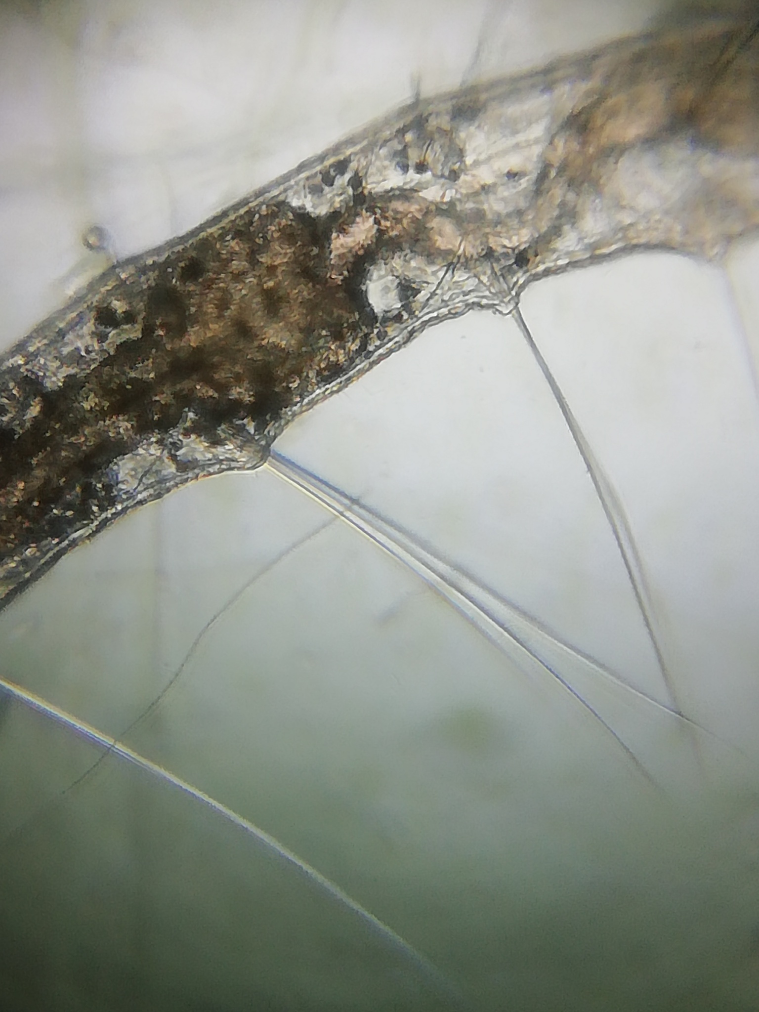 Stylaria fossularis Leidy, 1852