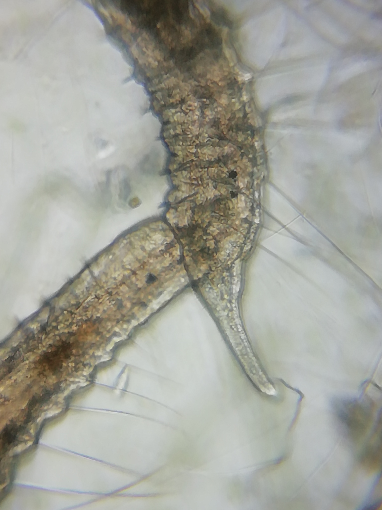 Stylaria fossularis Leidy, 1852