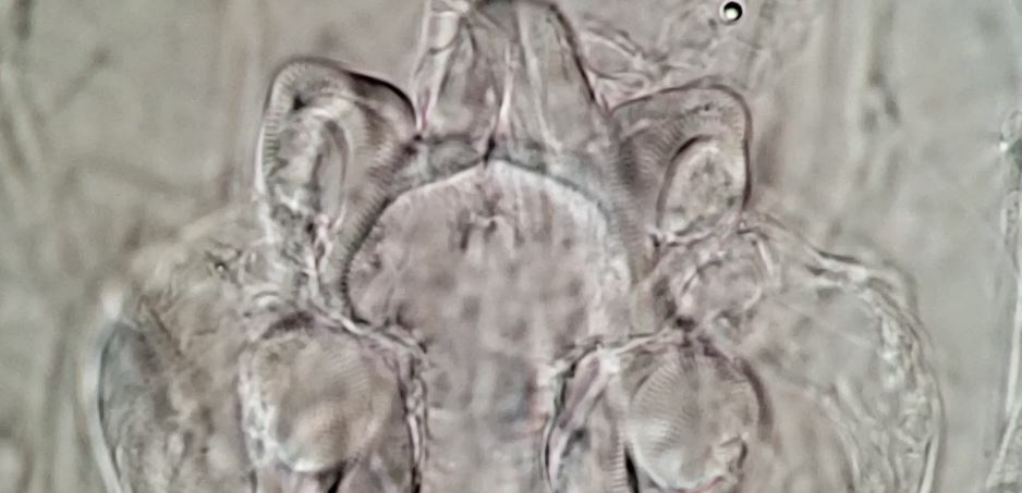 Synchaeta pectinata Ehrenberg, 1832