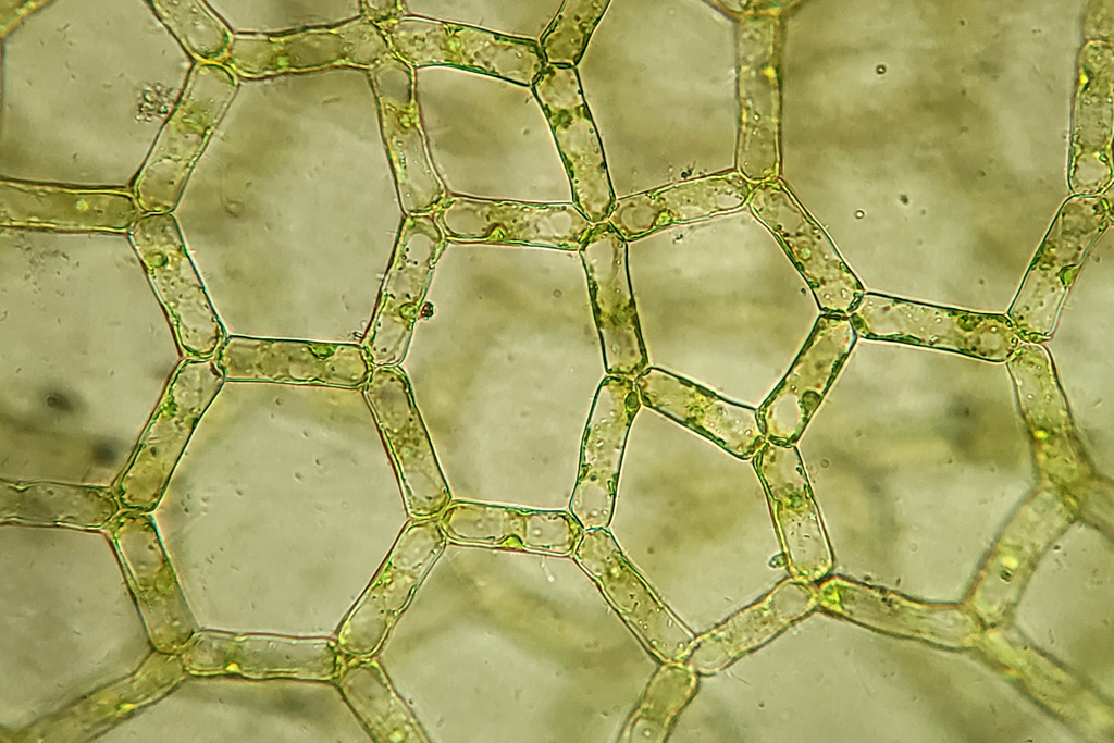 Water Nets from Fontana Park, Buchanan County, IA USA on August 18 ...