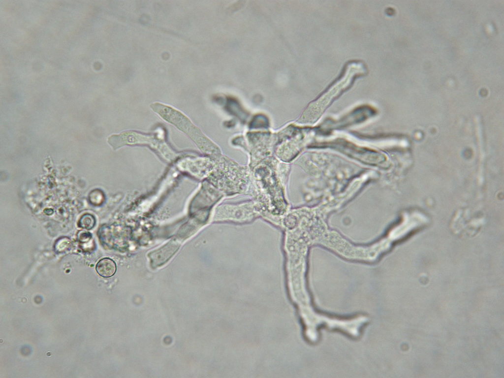 Polychaos (amoebas of the world) · iNaturalist