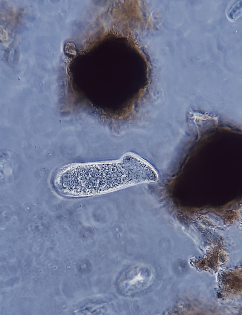 Spathidiidae in December 2022 by Isabella Ibarra. http://www.wfoissner ...