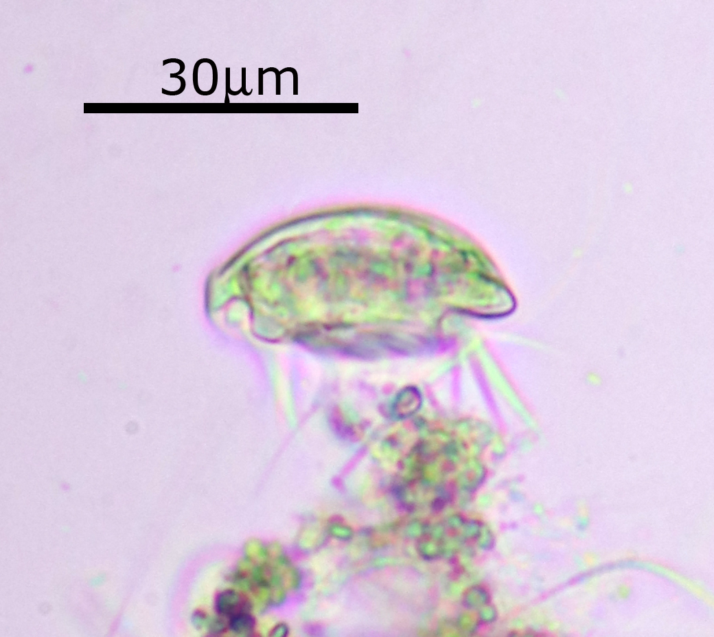 Aspidisca cicada (Müller, 1786) Claparède & Lachmann, 1858