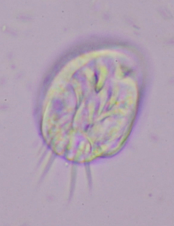 Aspidisca cicada (Müller, 1786) Claparède & Lachmann, 1858