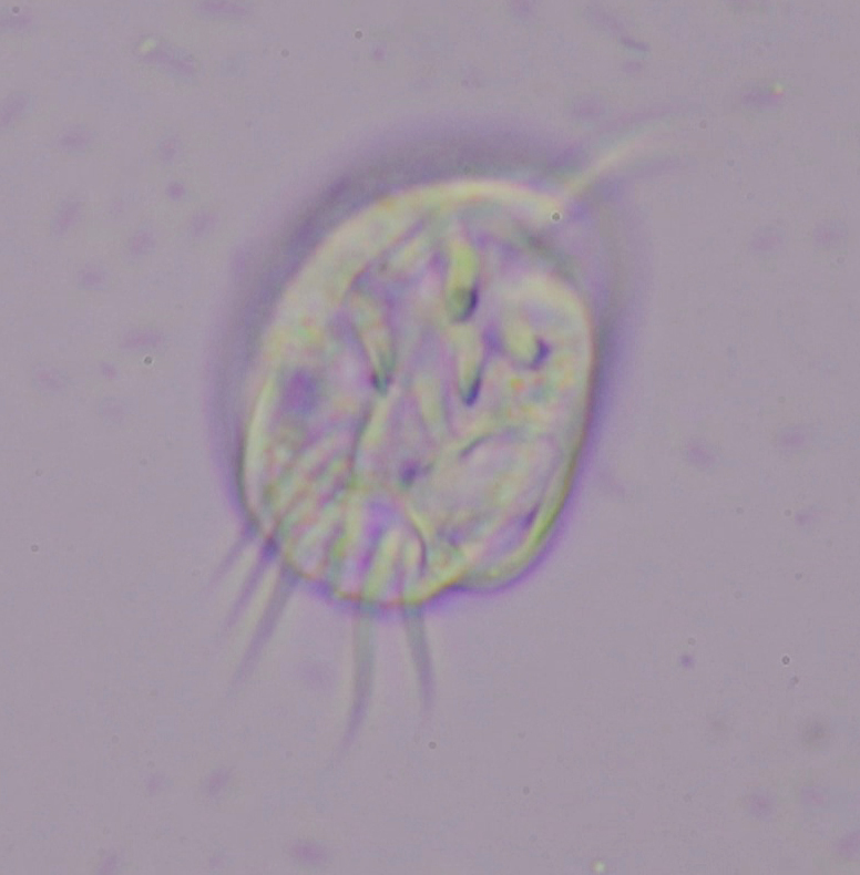 Aspidisca cicada (Müller, 1786) Claparède & Lachmann, 1858