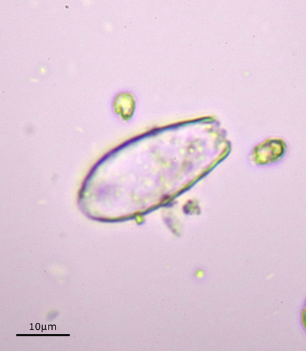 Euglypha laevis · iNaturalist