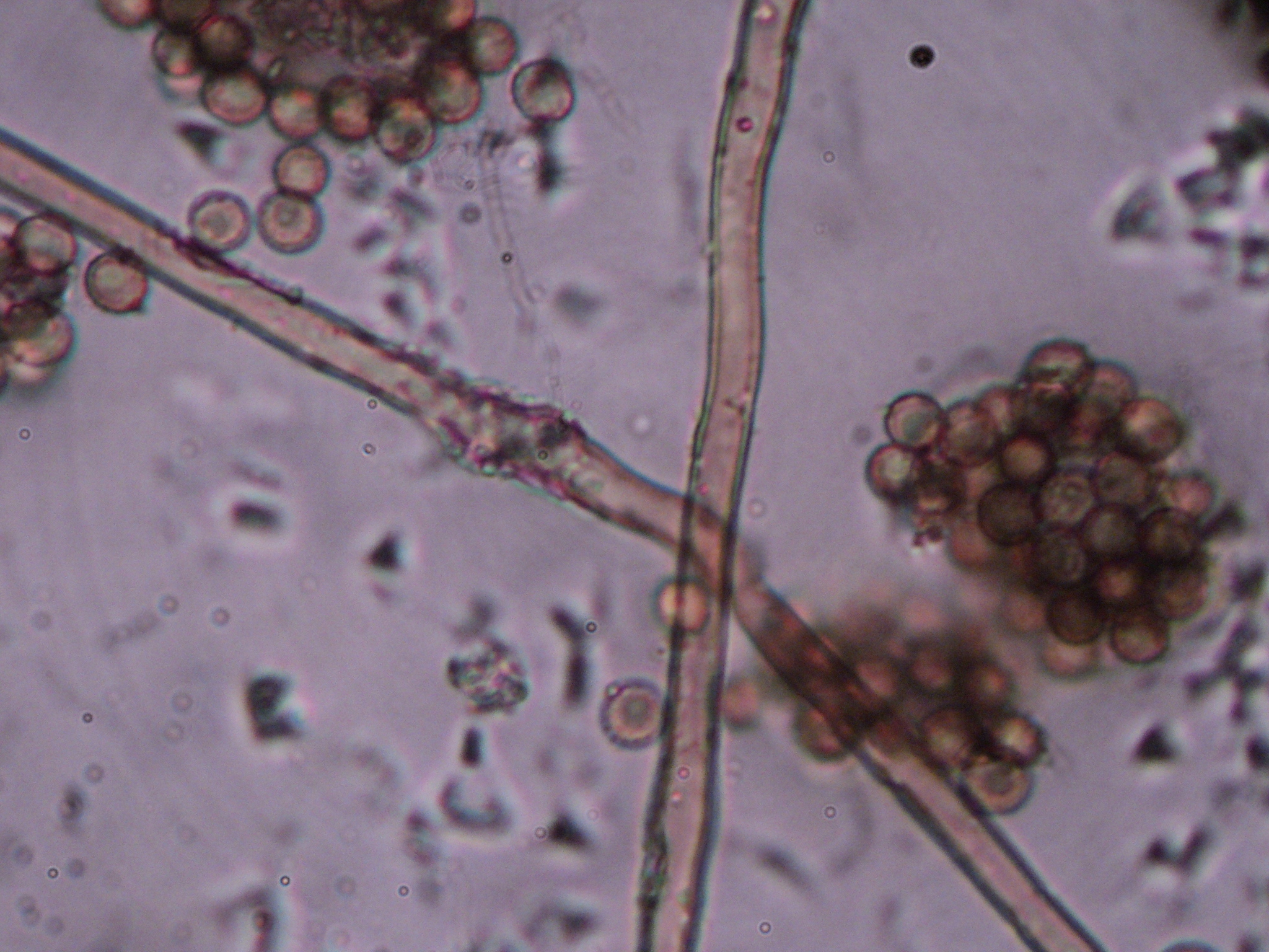 Lycoperdon dermoxanthum Vittad.