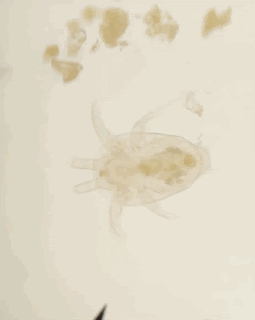 Cyclopoid Copepods from Tandy Hills Natural Area, Fort Worth, TX, US on ...