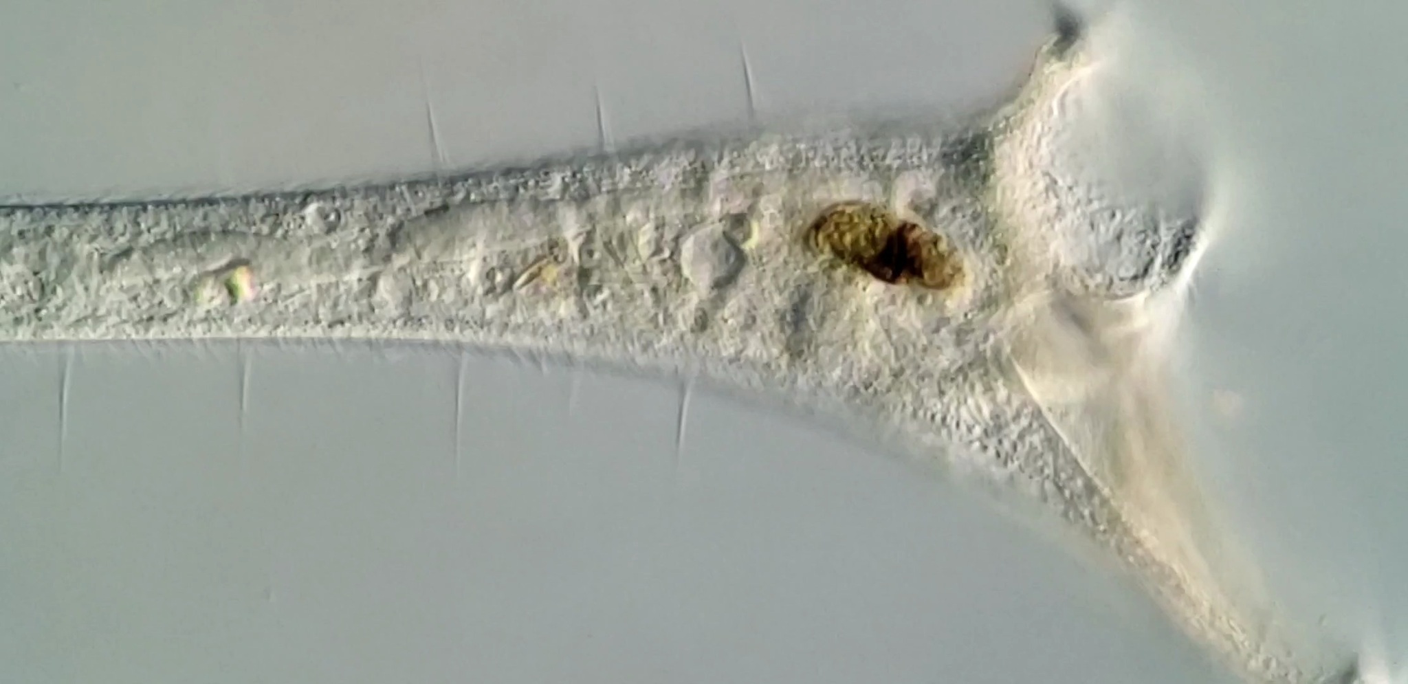 Stentor roeselii Ehrenberg, 1835