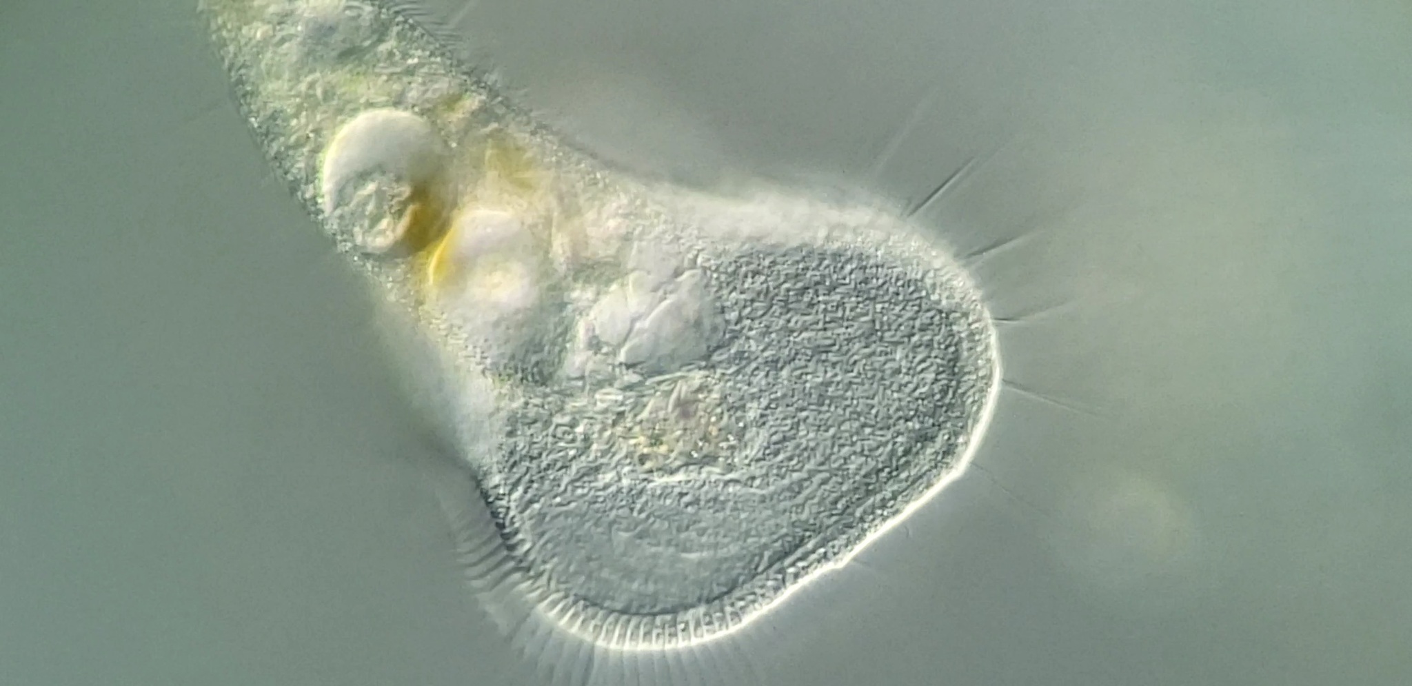 Stentor roeselii Ehrenberg, 1835