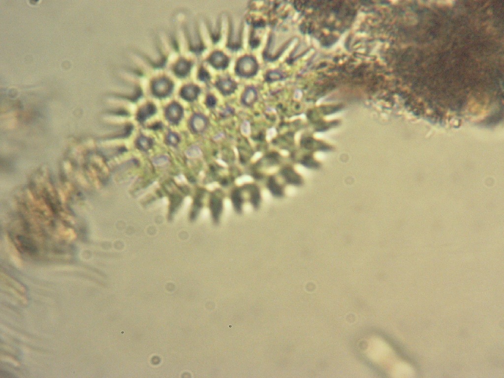 (Pediastrum duplex) - Botanical Realm