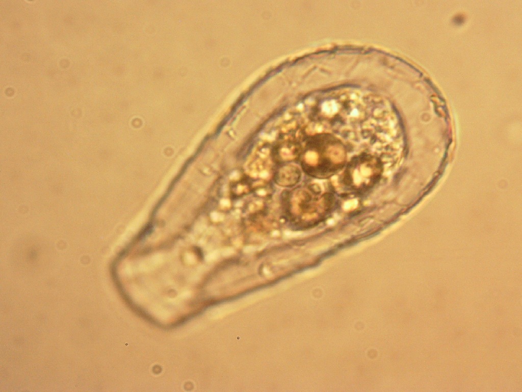 Quadrulella (amoebas of the world) · iNaturalist