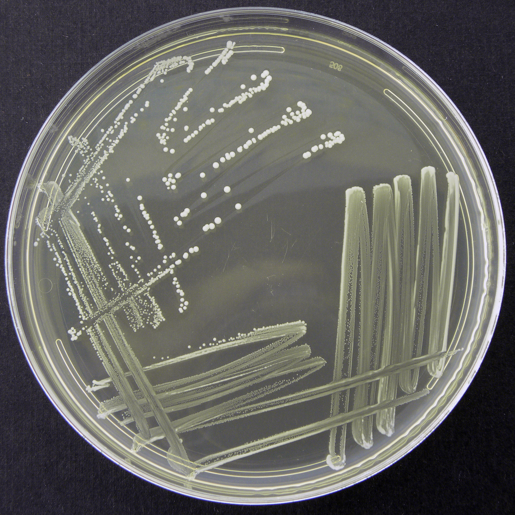 epidermal coagulase-negative staphylococcus from Northern Kentucky ...