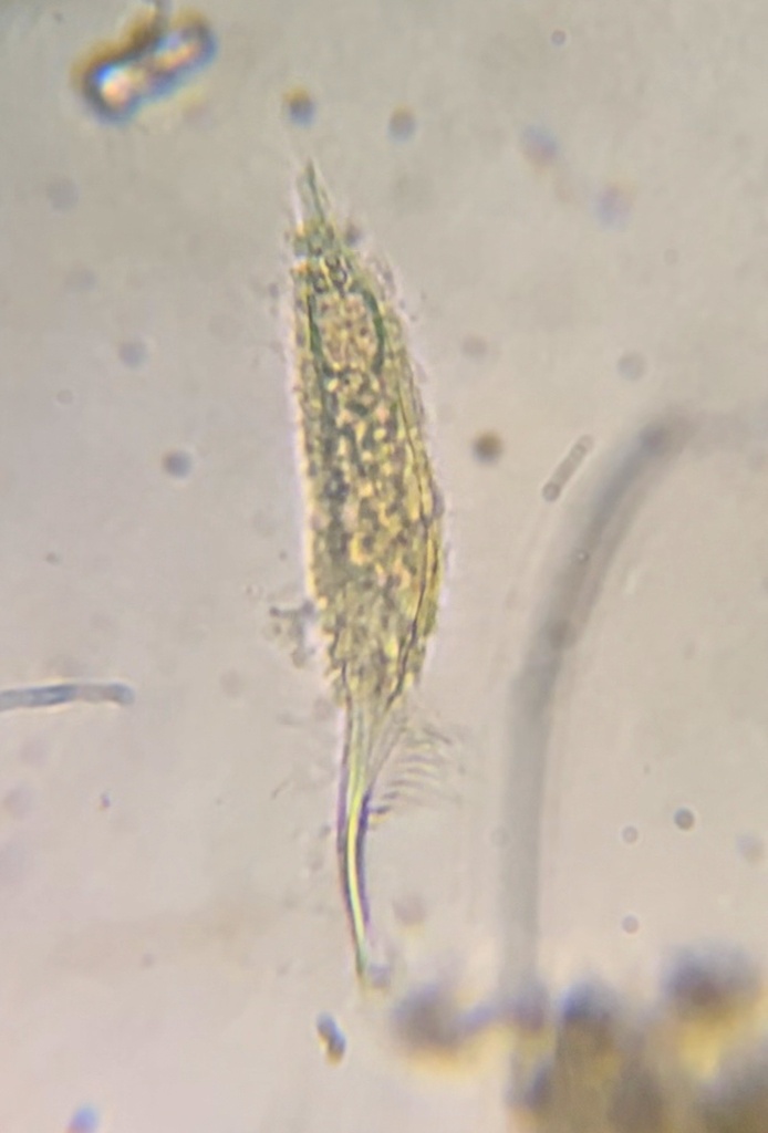 Metopus verrucosus from Ocean City, Ocean City, NJ, US on January 23 ...
