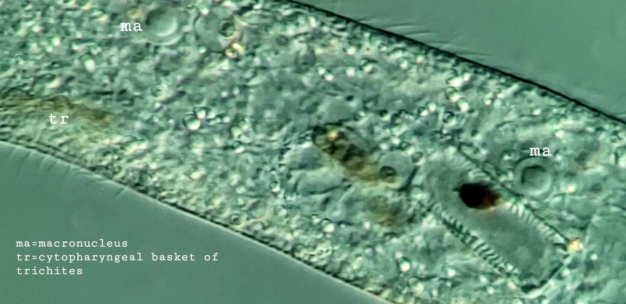 Loxodes striatus (Engelmann, 1862) Penard, 1917