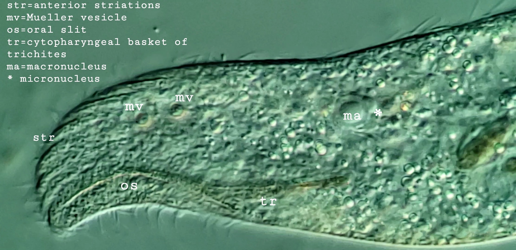 Loxodes striatus (Engelmann, 1862) Penard, 1917