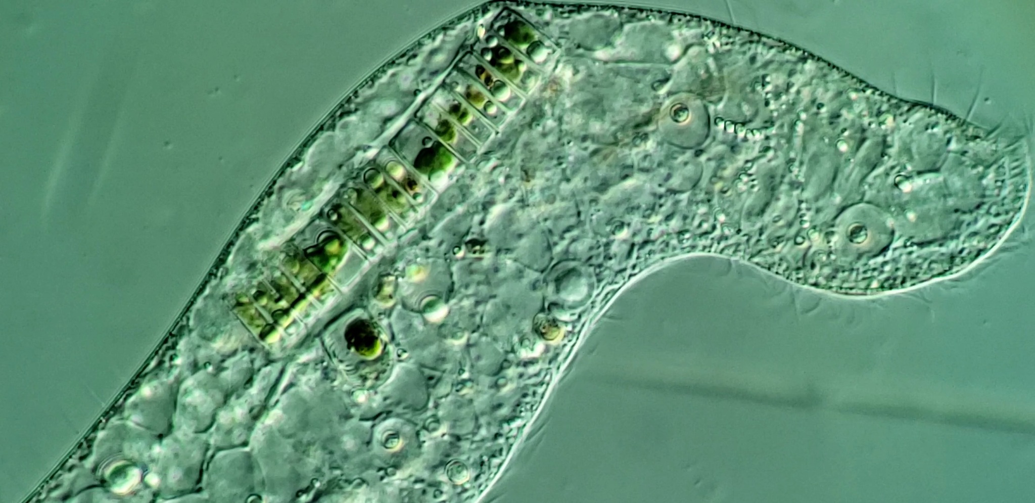 Loxodes striatus (Engelmann, 1862) Penard, 1917