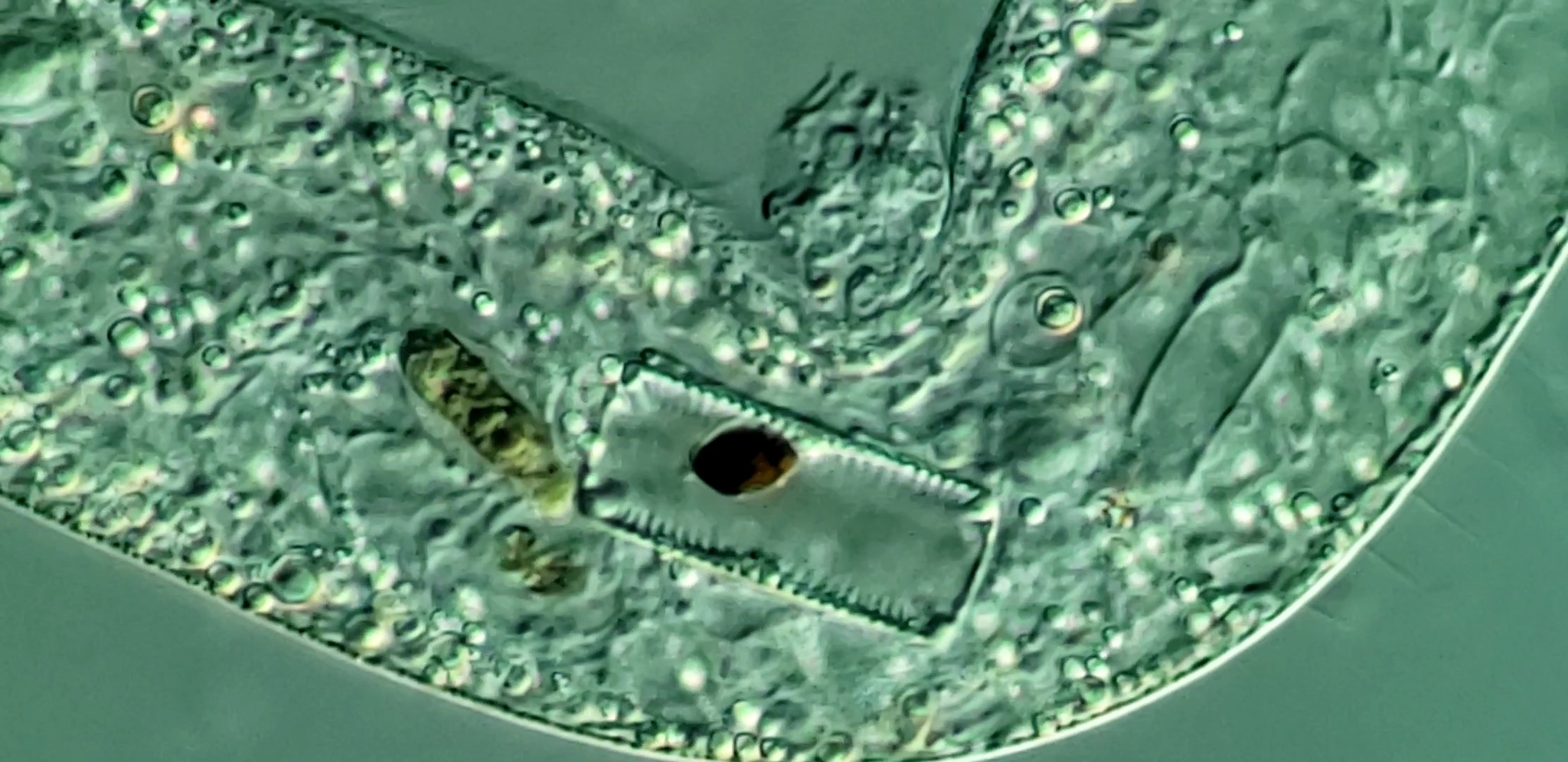 Loxodes striatus (Engelmann, 1862) Penard, 1917