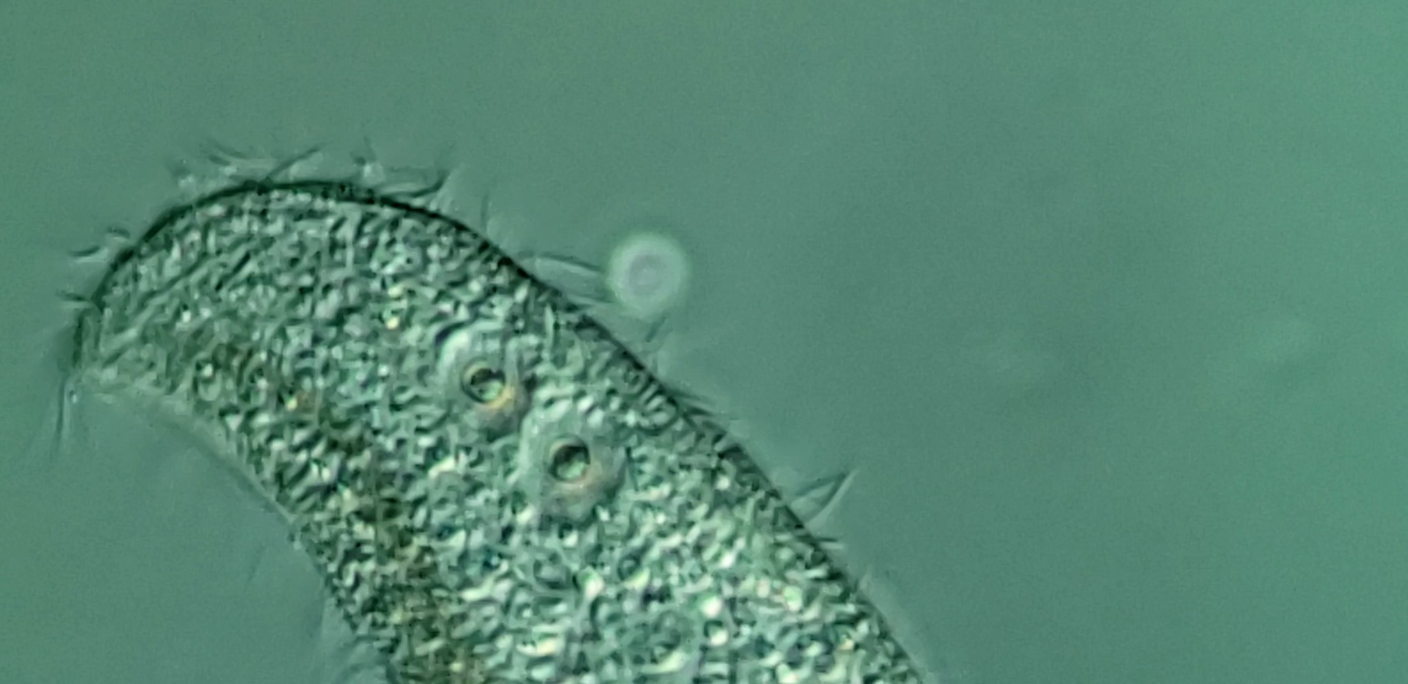 Loxodes striatus (Engelmann, 1862) Penard, 1917