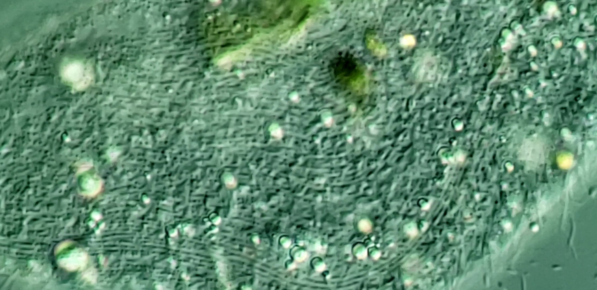 Loxodes striatus (Engelmann, 1862) Penard, 1917