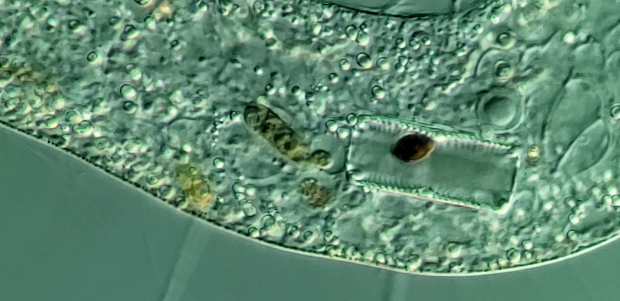 Loxodes striatus (Engelmann, 1862) Penard, 1917