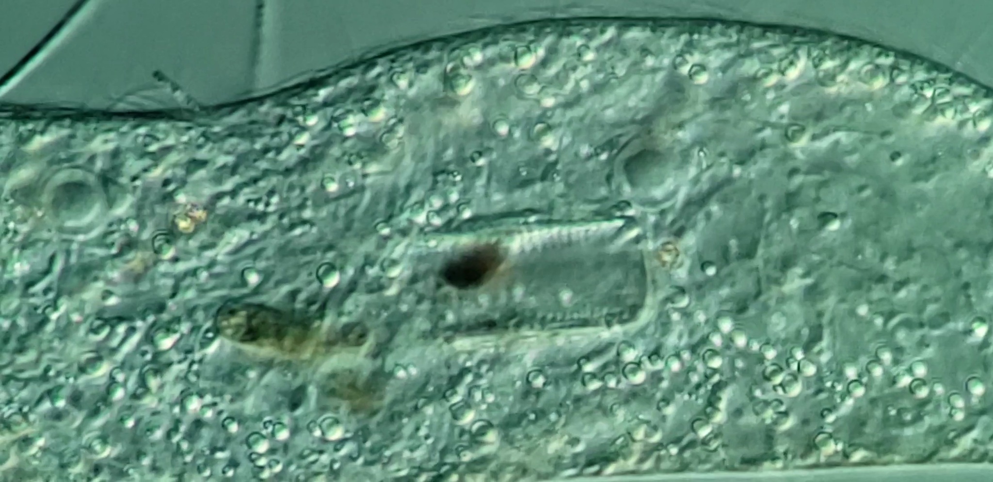 Loxodes striatus (Engelmann, 1862) Penard, 1917