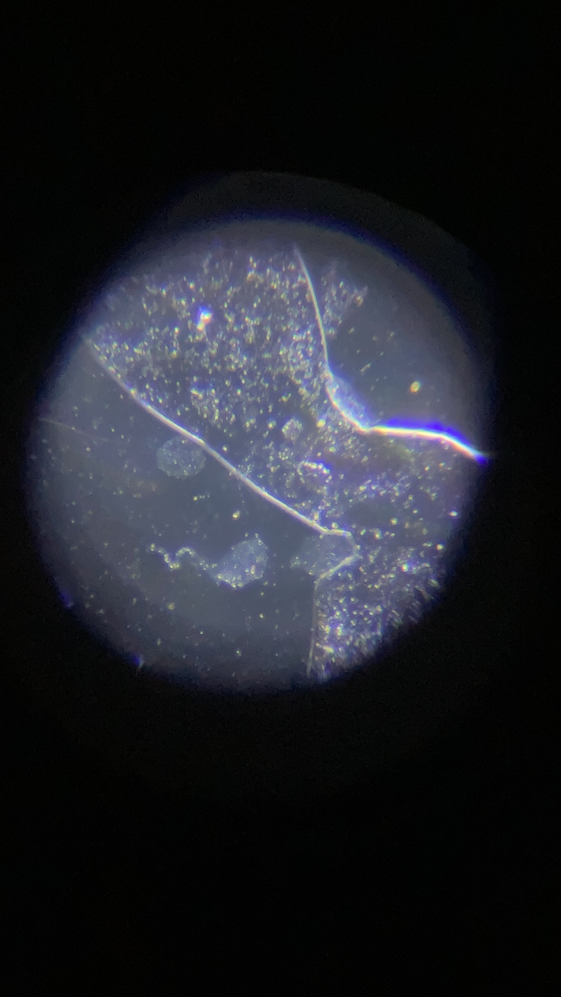 Leptothrix discophora