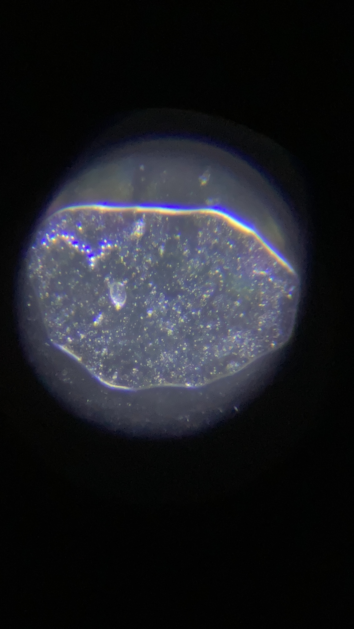 Leptothrix discophora