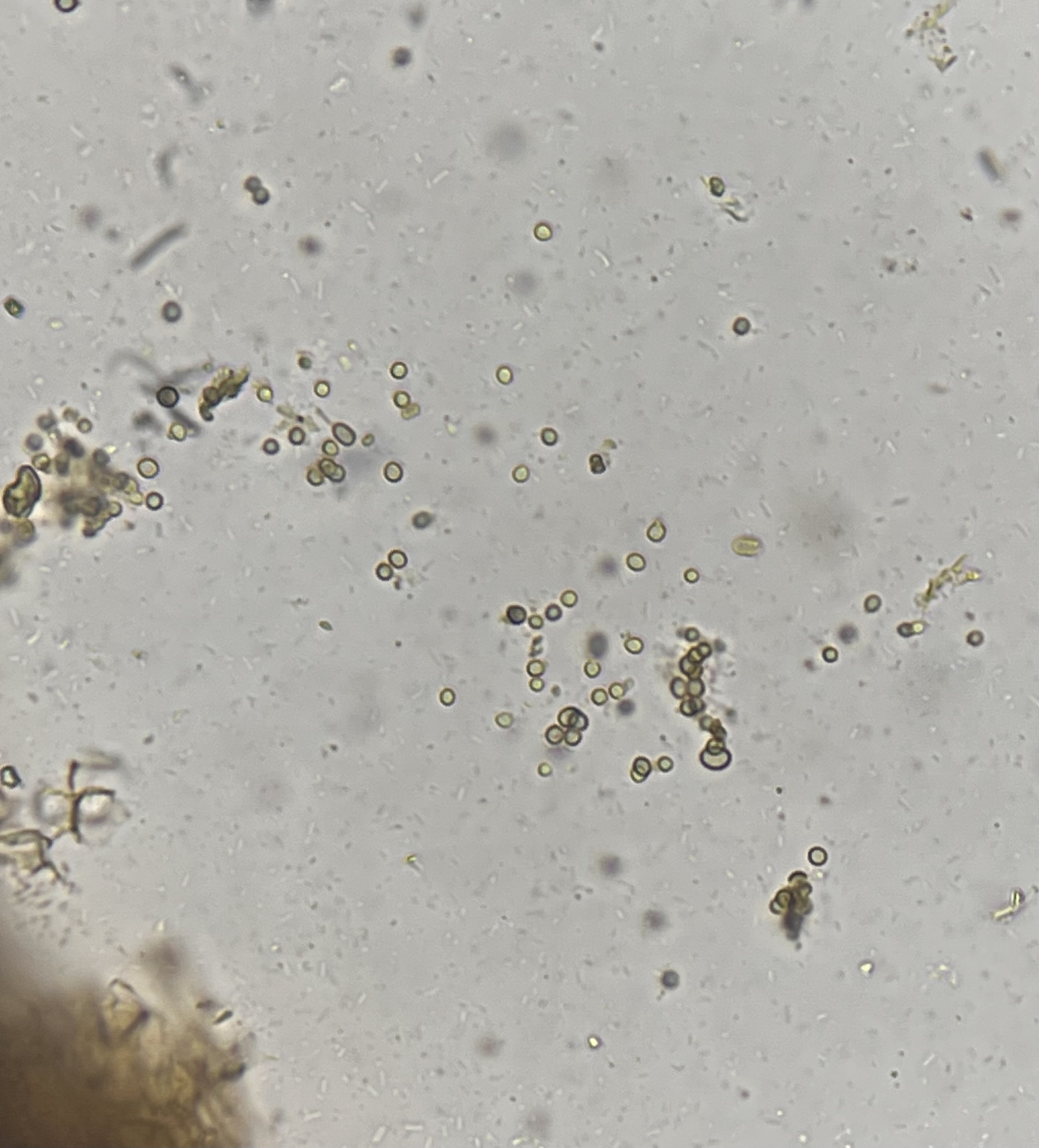 Trichoderma lixii (Pat.) P.Chaverri