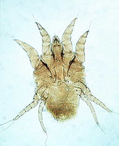 Scab Mite (Psoroptidae)