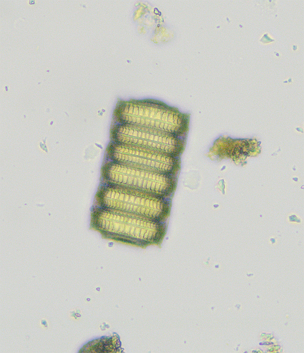 Paralia sulcata (Encyclopedia of Diatoms Found in the USA ) · iNaturalist