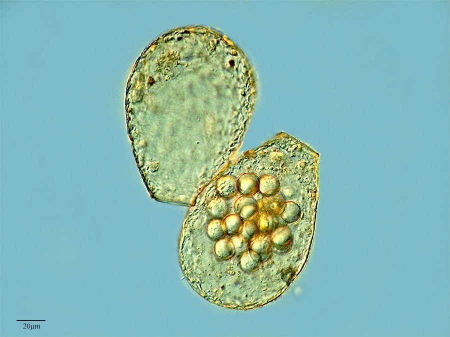 Heleopera sphagni (amoebas of the world) · iNaturalist