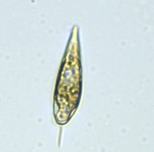 Fitoplancton (Prorocentrum gracile)