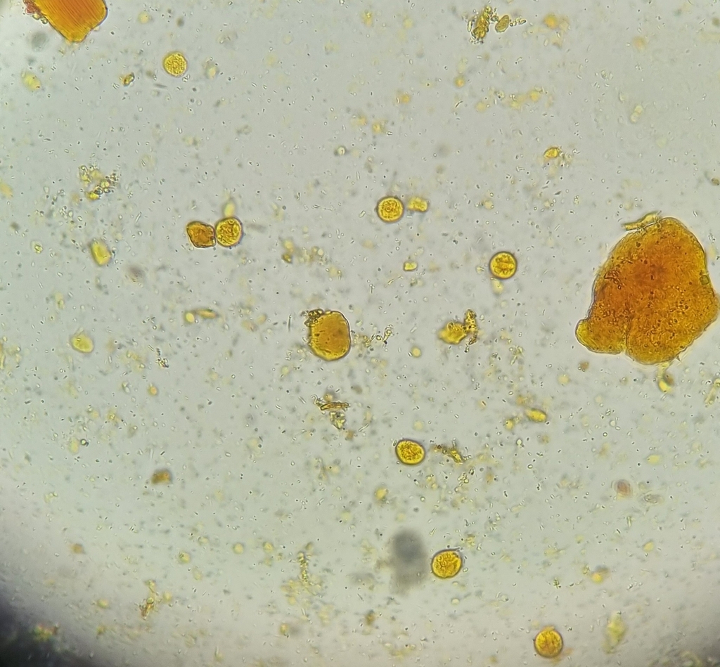 Entamoeba coli in March 2023 by Andrius Kubilius · iNaturalist